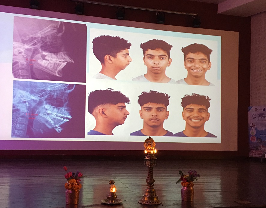 धुलिखेल अस्पतालमा ‘नेपाल स्लिप सम्मेलन–२०२५’ सम्पन्न « News of Nepal